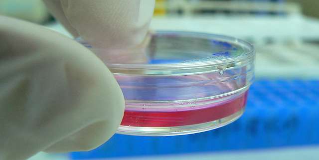 Using a Colorimetric Assay to Monitor Cell Growth | HunterLab